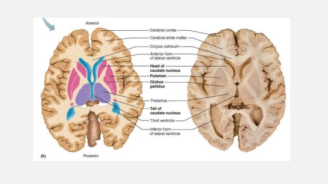 Ncct and cect brain and orbit | PPTX | Blood Disorders | Diseases and ...