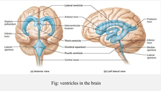 Ncct and cect brain and orbit | PPTX | Blood Disorders | Diseases and ...