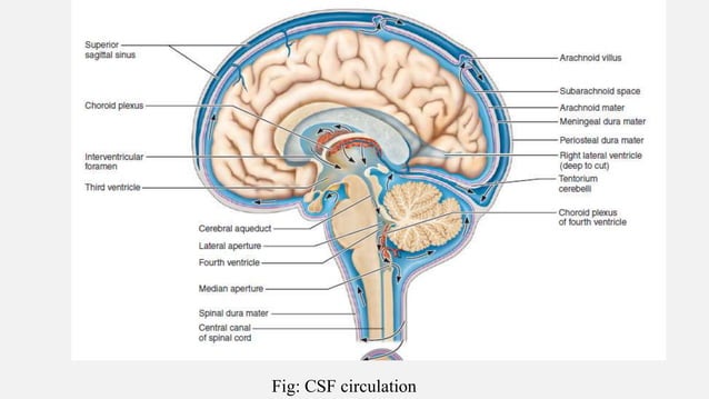 Ncct and cect brain and orbit | PPTX | Blood Disorders | Diseases and ...