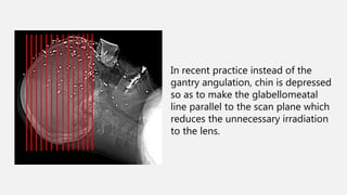 Ncct and cect brain and orbit | PPTX
