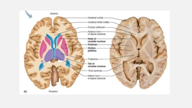 Ncct And Cect Brain And Orbit