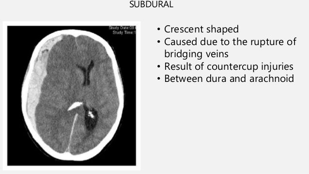 Ncct and cect brain and orbit