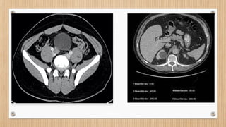 NCCT& CECT Pelvis for radiology students | PPTX