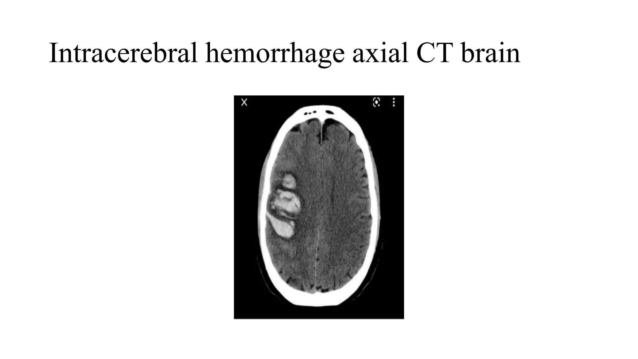 NCCT OR CECT HEAD.(RUKMANEE YADAV) | PPTX