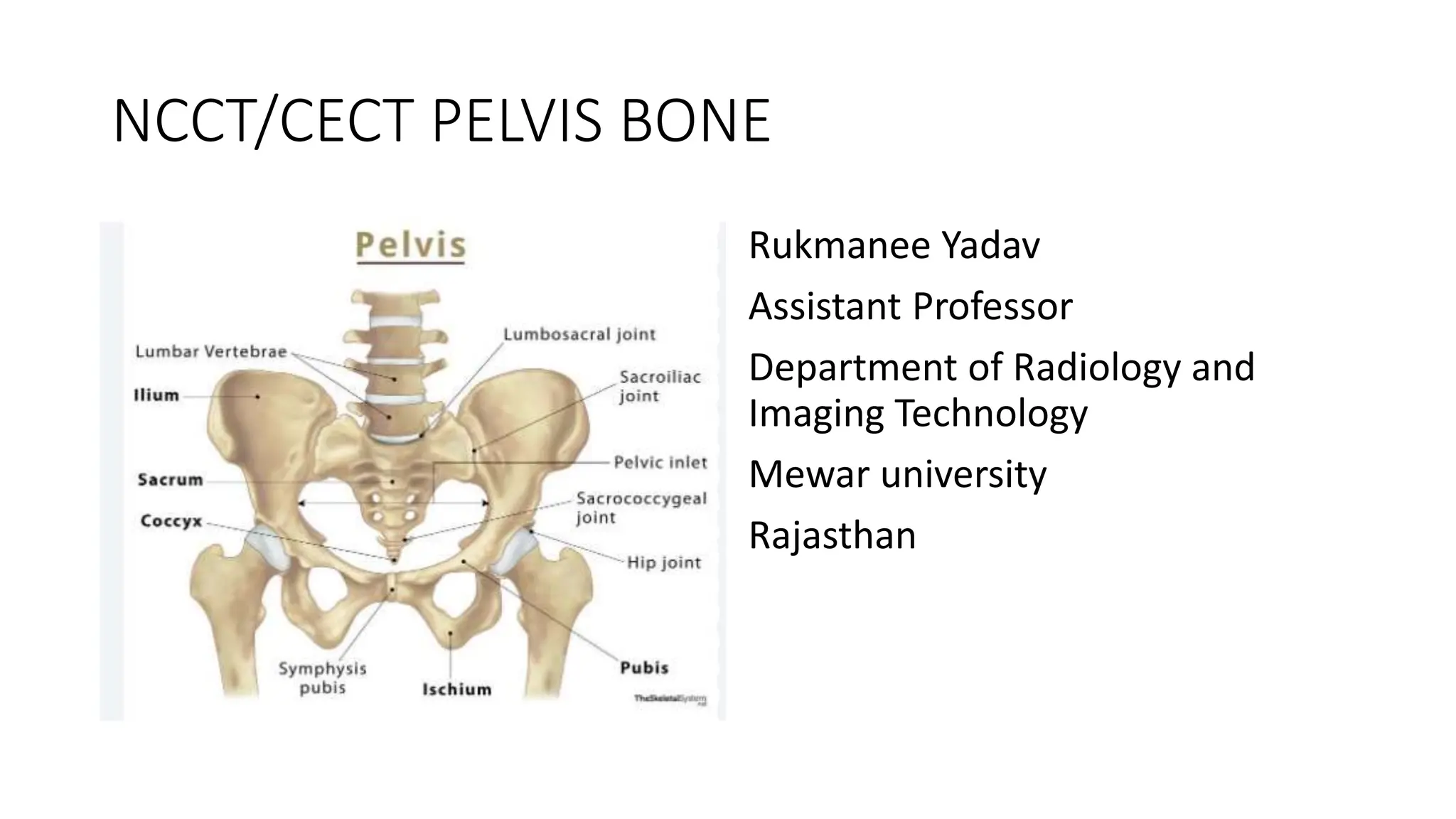 NCCT OR CECT PELVIS BONE.pptx, INDICATIONS OF PELVIS BONE | PPTX