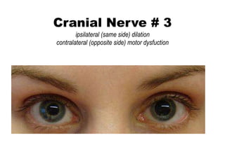 Nc head and spinal trauma | PPT