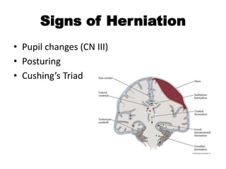 Nc head and spinal trauma | PPT
