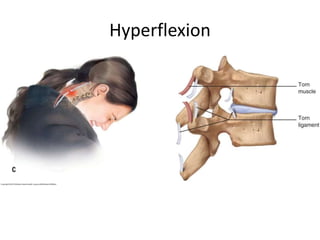 Nc head and spinal trauma | PPT