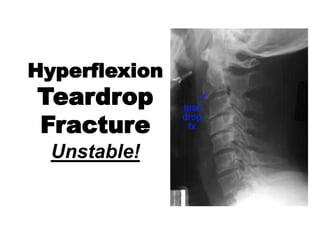 Nc head and spinal trauma | PPT