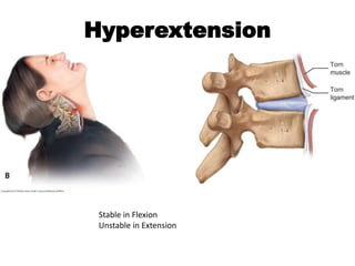 Nc head and spinal trauma | PPT