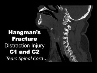 Nc head and spinal trauma | PPT
