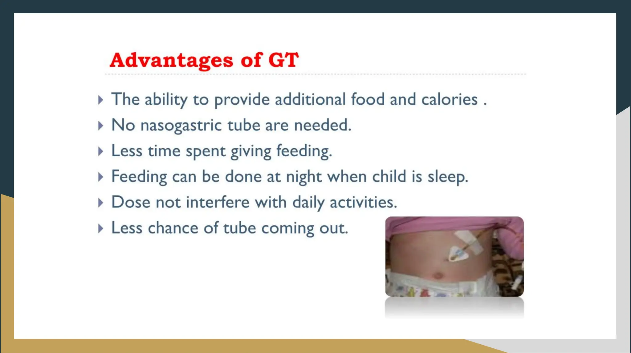 TOPICS TPN (Total Parenteral Nutrition)I Nasogastric Tube Insertion ...