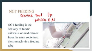 TOPICS TPN (Total Parenteral Nutrition)I Nasogastric Tube Insertion ...