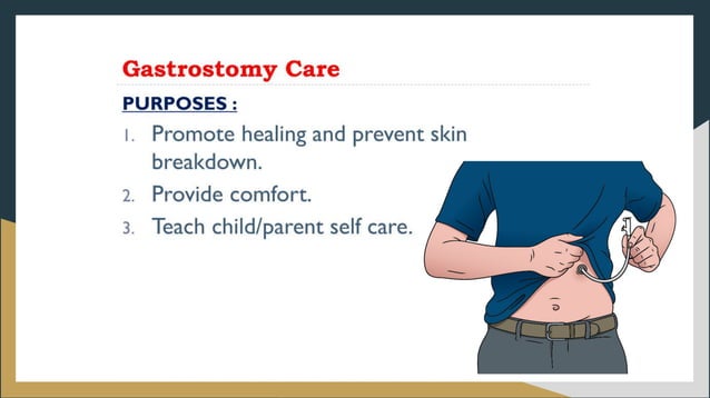 TOPICS TPN (Total Parenteral Nutrition)I Nasogastric Tube Insertion ...