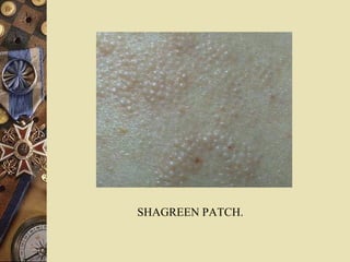 neuro cutaneous markers | PPT