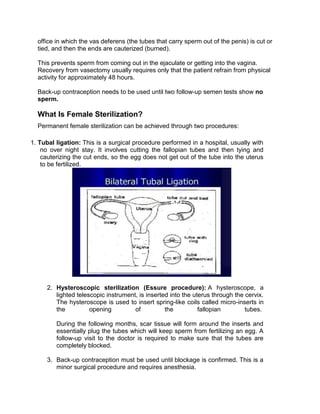 In Vitro Fertilization & Family Planning Method | DOC