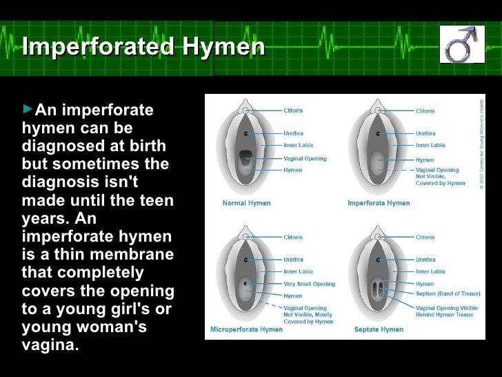 REPRODUCTIVE DISORDERS OF FISHER, FILAMER