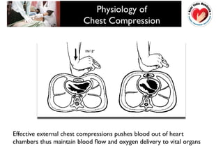 NCORT BLS for HCW 2015 ppt_220704_103351.pdf