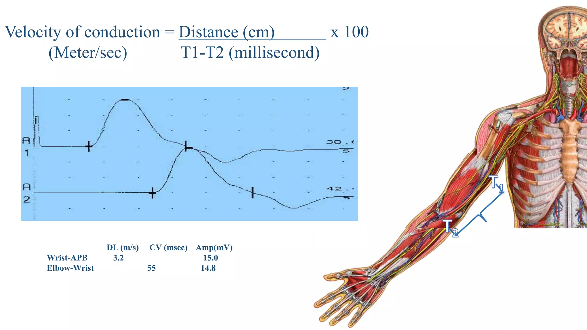 Nerve conduction studies | PPSX