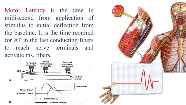 Nerve conduction studies | PPSX | Brain and Nervous System Disorders ...