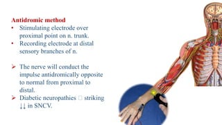 Nerve conduction studies | PPSX
