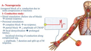 Nerve conduction studies | PPSX