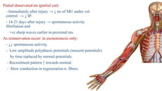 Nerve conduction studies | PPSX
