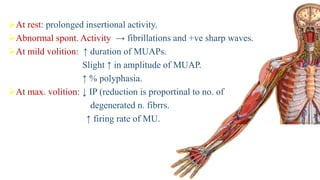 Nerve conduction studies | PPSX