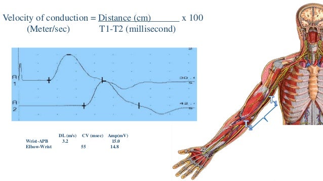Nerve Conduction Study Video