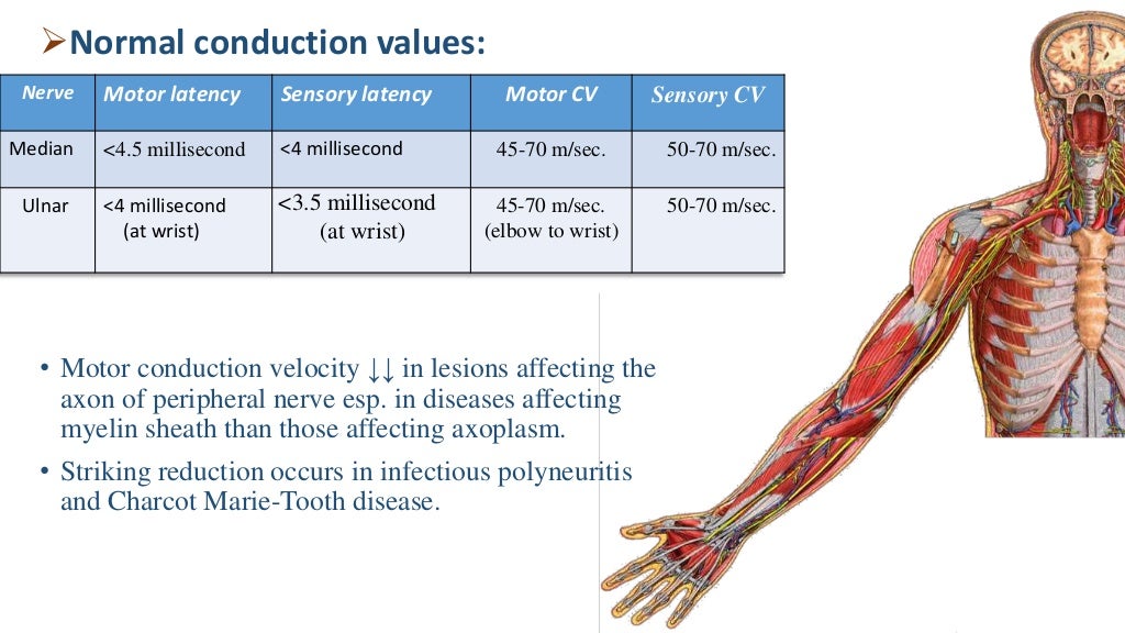 Nerve conduction studies