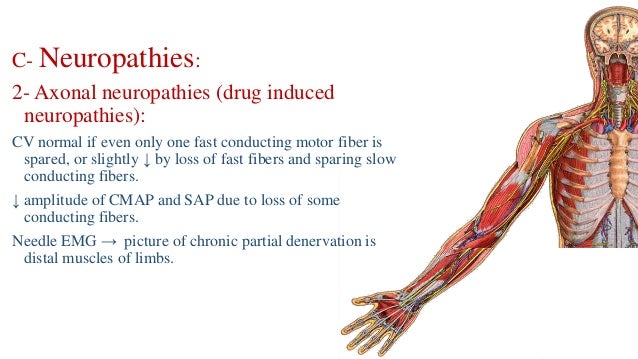 Nerve conduction studies