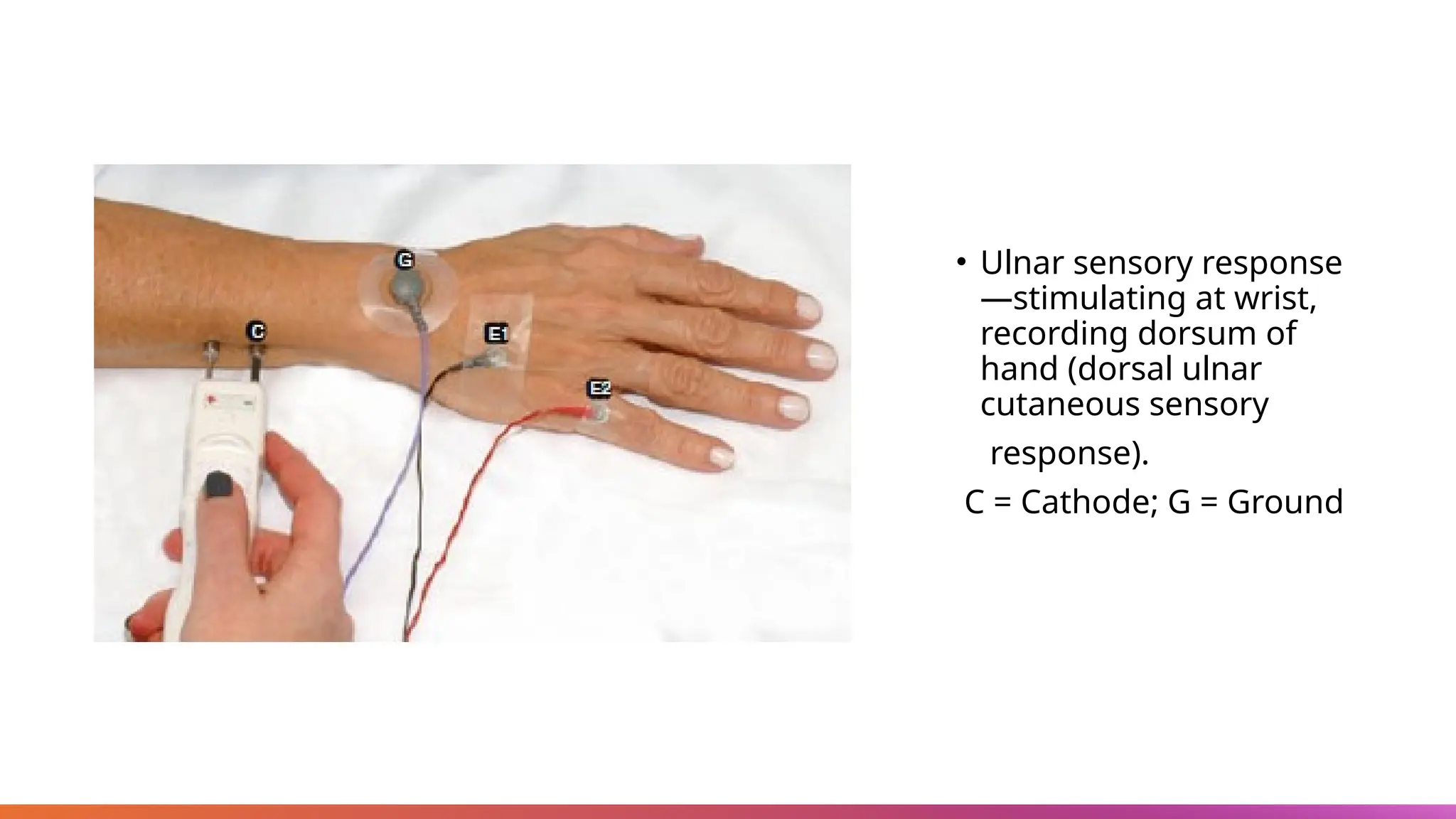 Nerve conduction studies second presentation | PPT