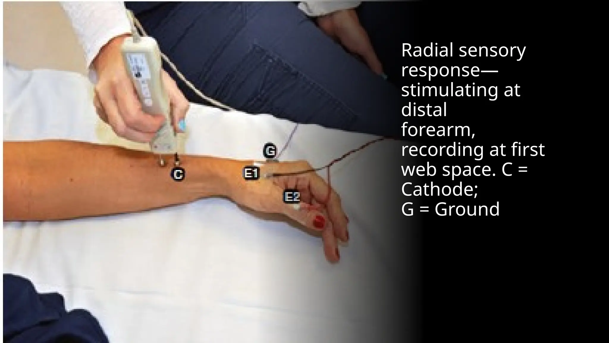 Nerve conduction studies second presentation | PPT