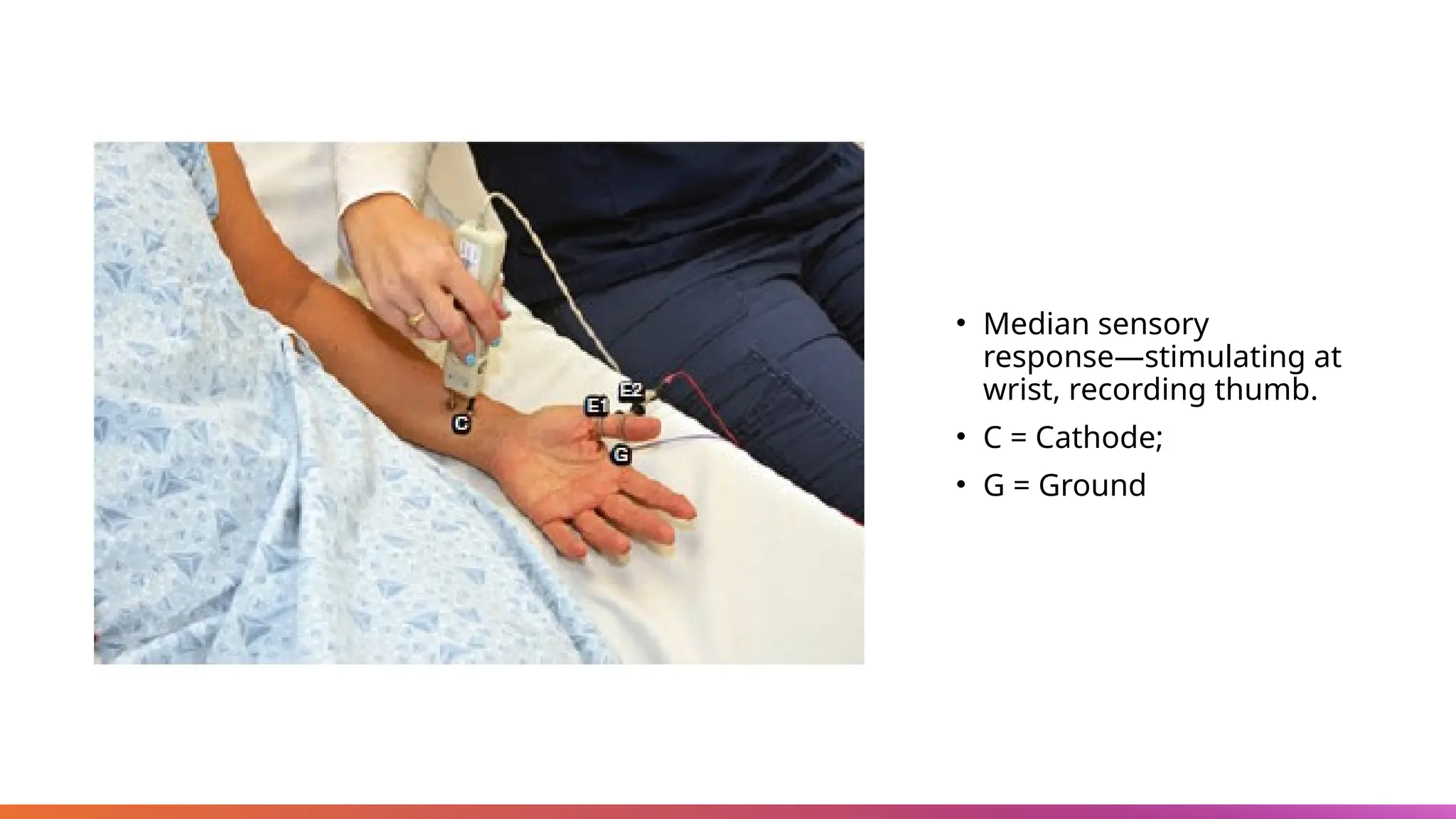 Nerve conduction studies second presentation | PPT