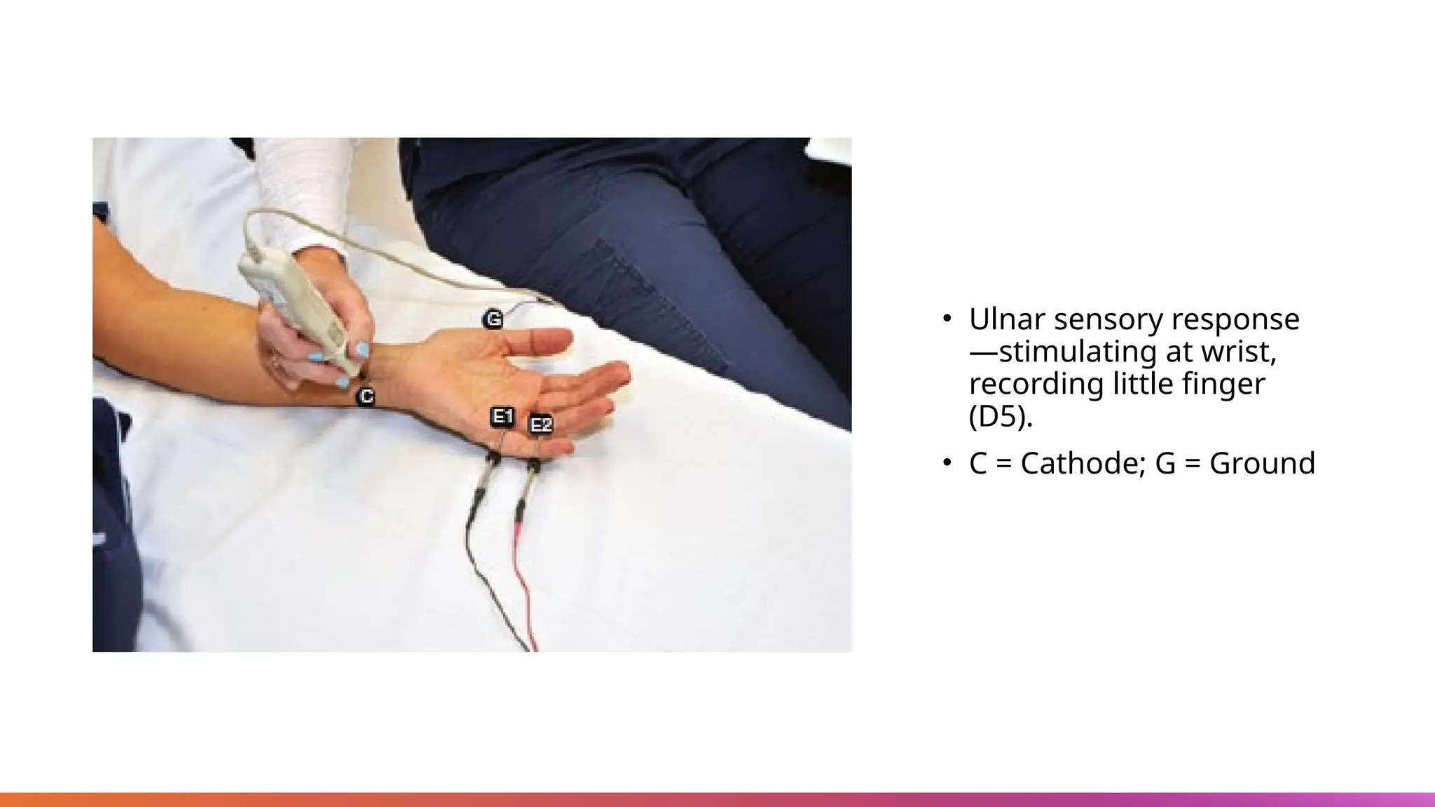 Nerve conduction studies second presentation | PPT