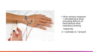 Nerve conduction studies second presentation | PPTX