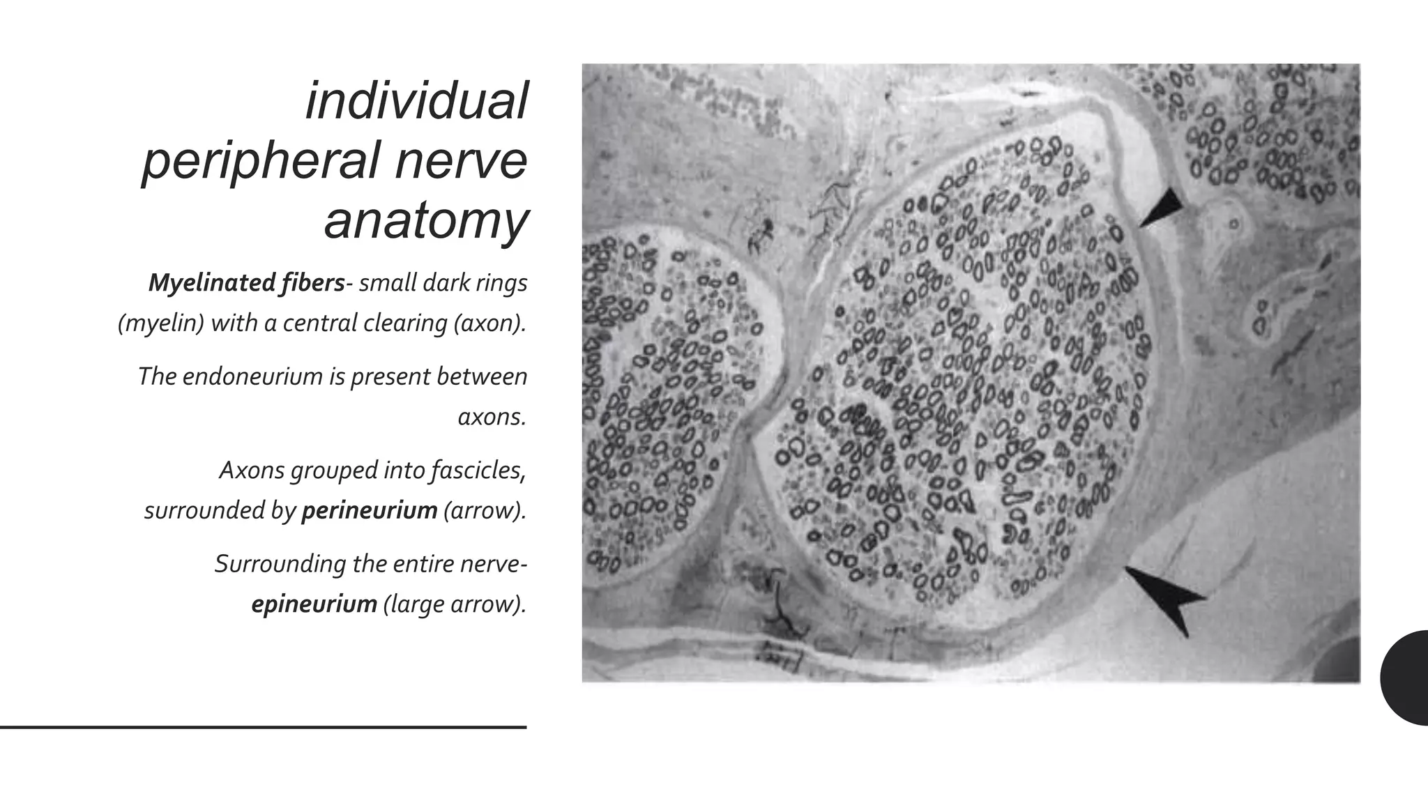 NERVE CONDUCTION STUDIES, ELECTROMYOGRAPHY | PPTX