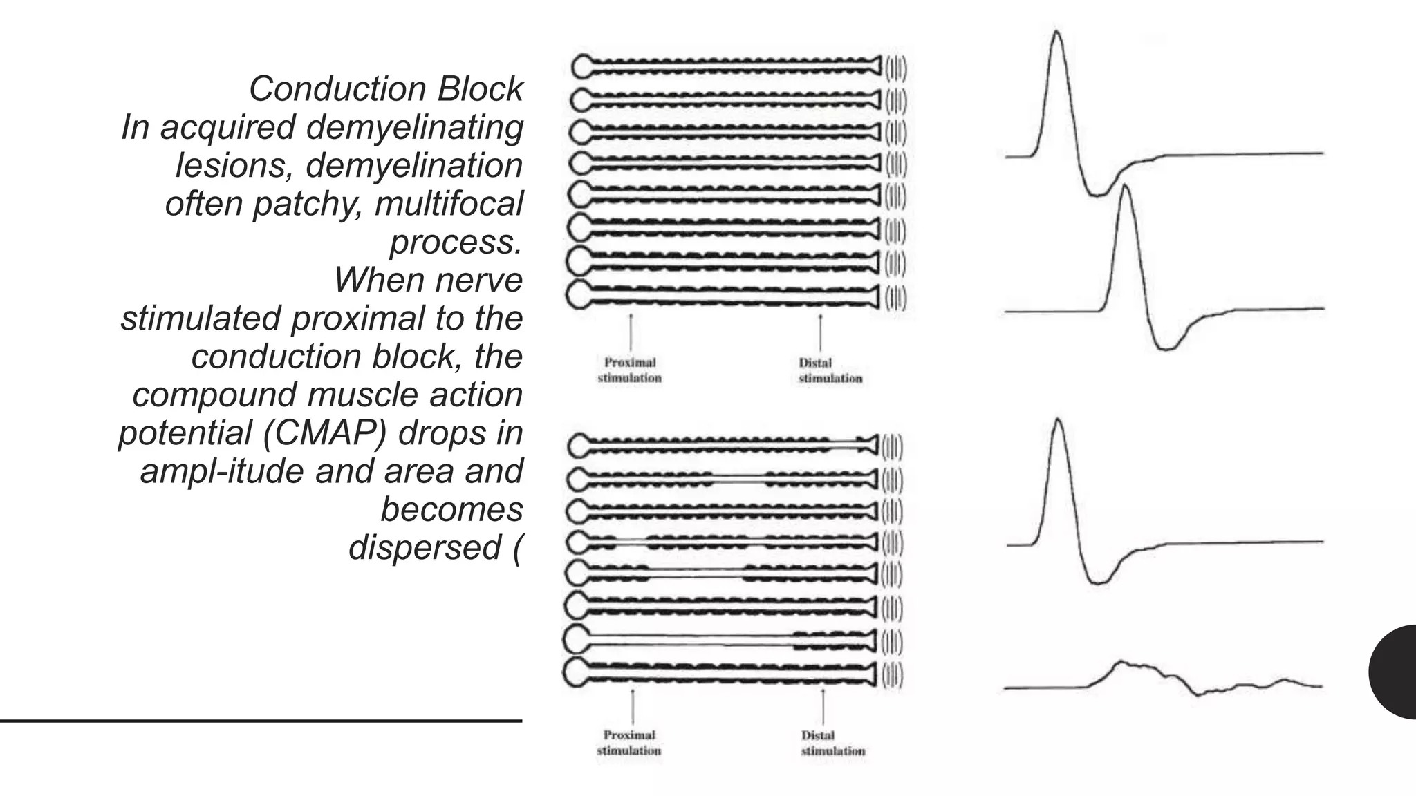 NERVE CONDUCTION STUDIES, ELECTROMYOGRAPHY | PPTX | Brain and Nervous ...