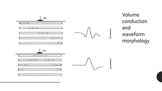 NERVE CONDUCTION STUDIES, ELECTROMYOGRAPHY | PPTX
