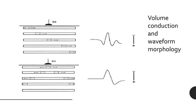 NERVE CONDUCTION STUDIES, ELECTROMYOGRAPHY | PPTX | Brain and Nervous ...