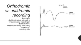 NERVE CONDUCTION STUDIES, ELECTROMYOGRAPHY | PPTX