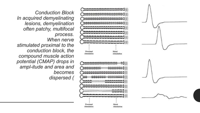 NERVE CONDUCTION STUDIES, ELECTROMYOGRAPHY | PPTX | Brain and Nervous ...