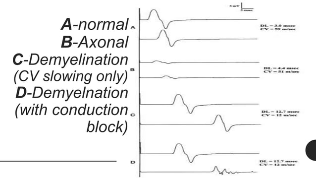 NCV AND EMG | PPTX