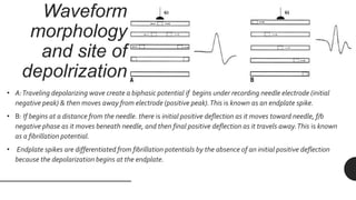 NCV AND EMG | PPTX