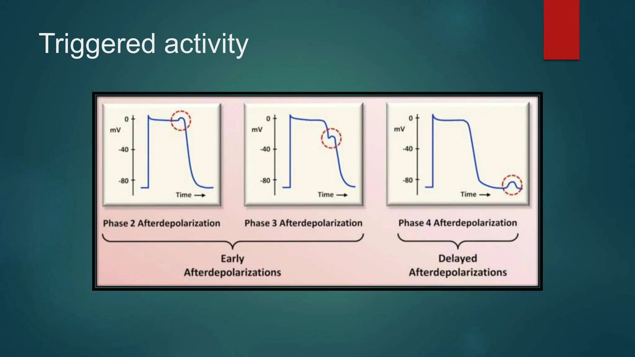 Narrow complex tachycardia/supraventricular tachycardia | PPTX