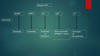 Narrow complex tachycardia/supraventricular tachycardia | PPTX
