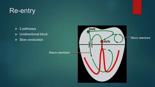 Narrow complex tachycardia/supraventricular tachycardia | PPTX