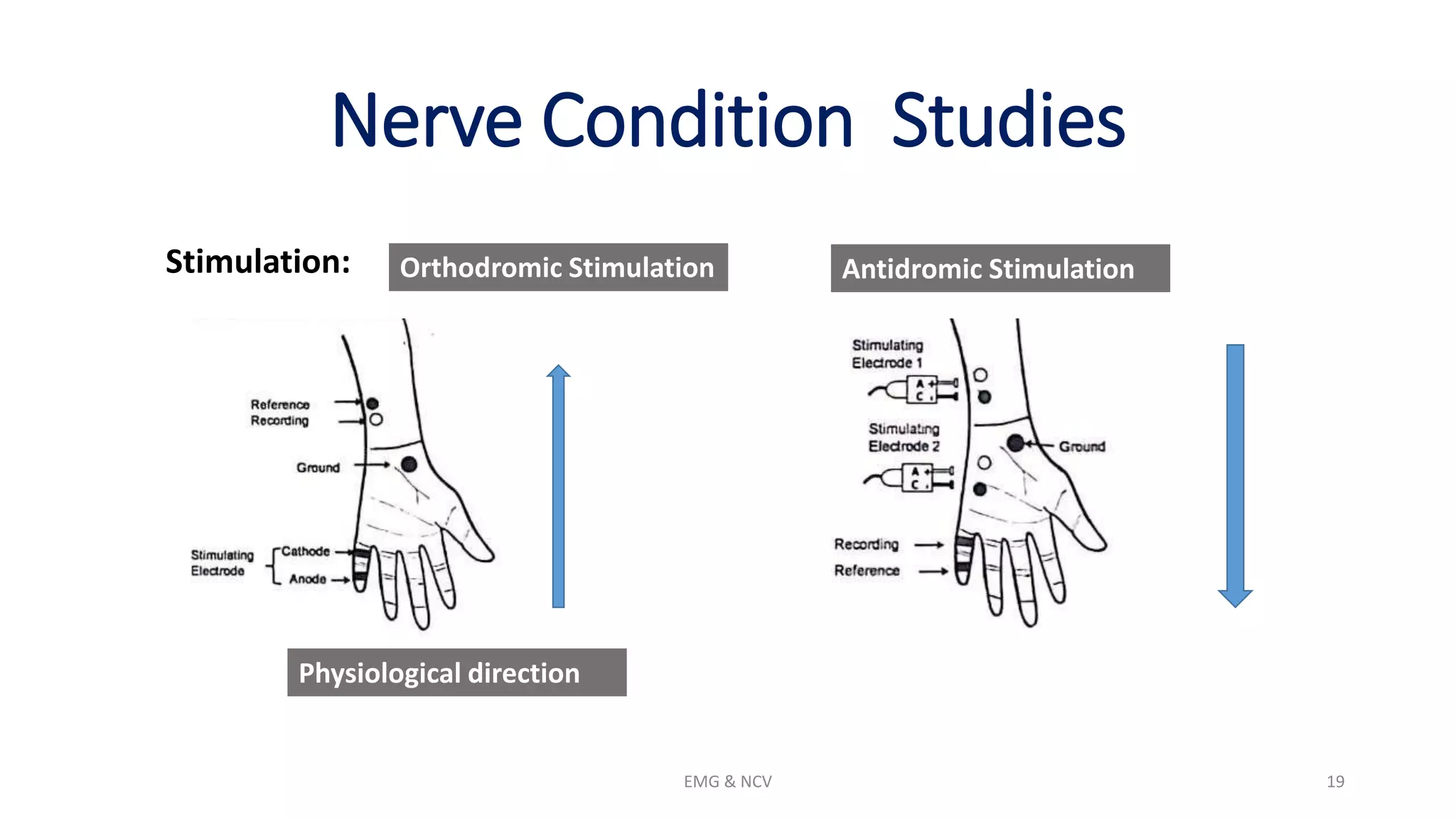 NCV and EMG.pptx