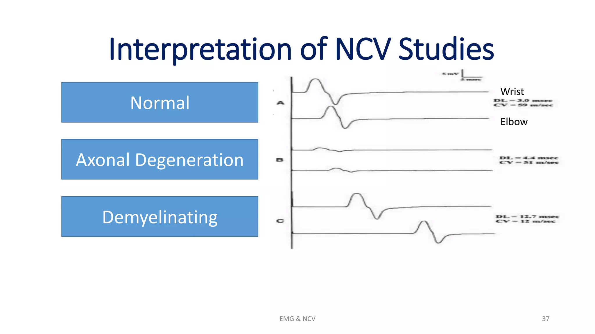 NCV and EMG.pptx