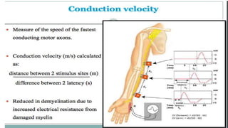 Ncv formula | PPT